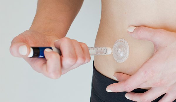 HCE Equipment and Supplies – HCE Medical Group